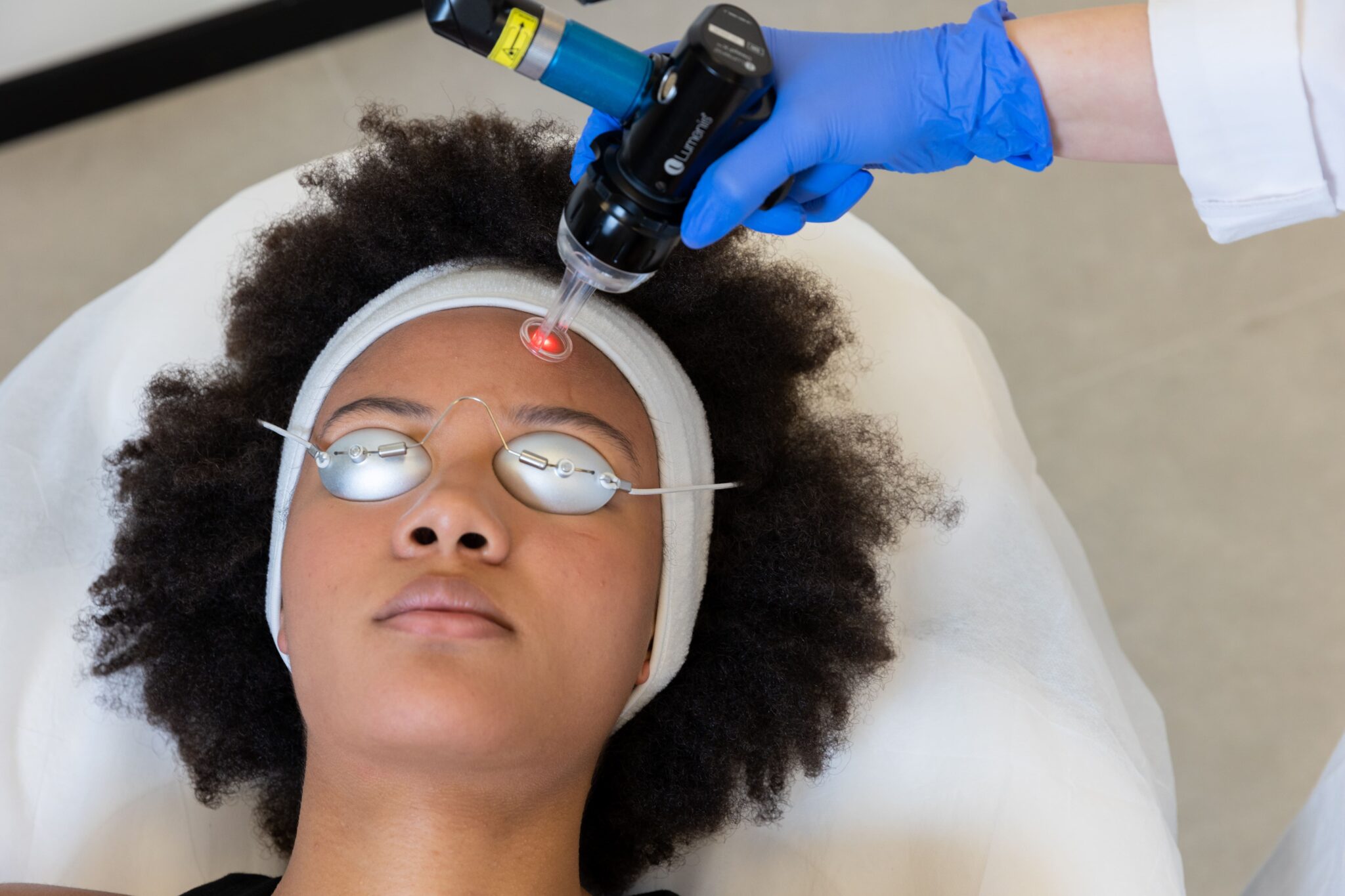 Ultrapulse Alpha - Dermatología y Estética-Demax Clinic Sevilla